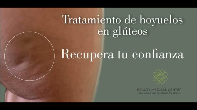 Hoyuelos En Los Gluteos | Actualizado diciembre 2025